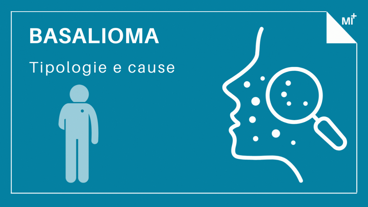 Basalioma: tipologie, cause, pericolosità - Infografica