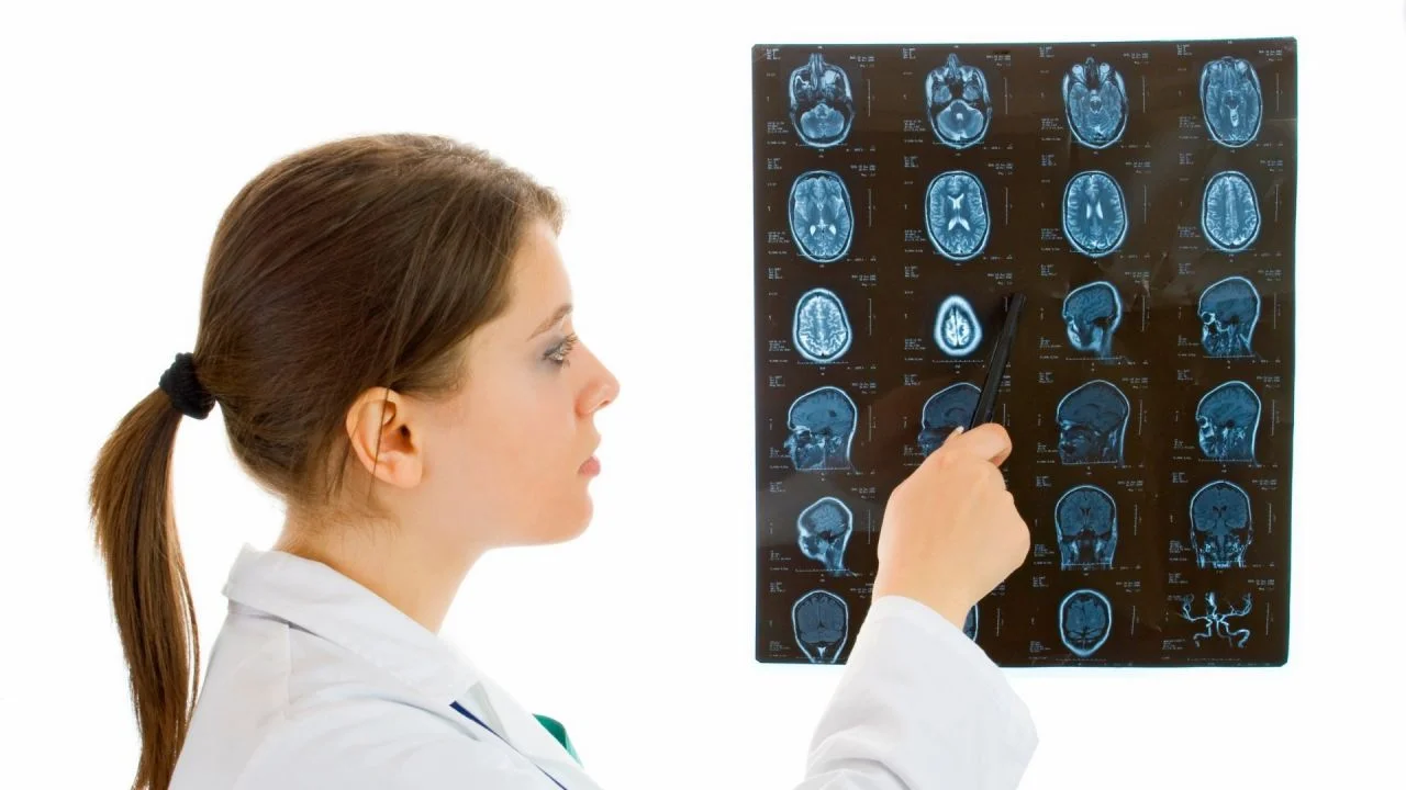 Cefalee secondarie: diagnosi e cause