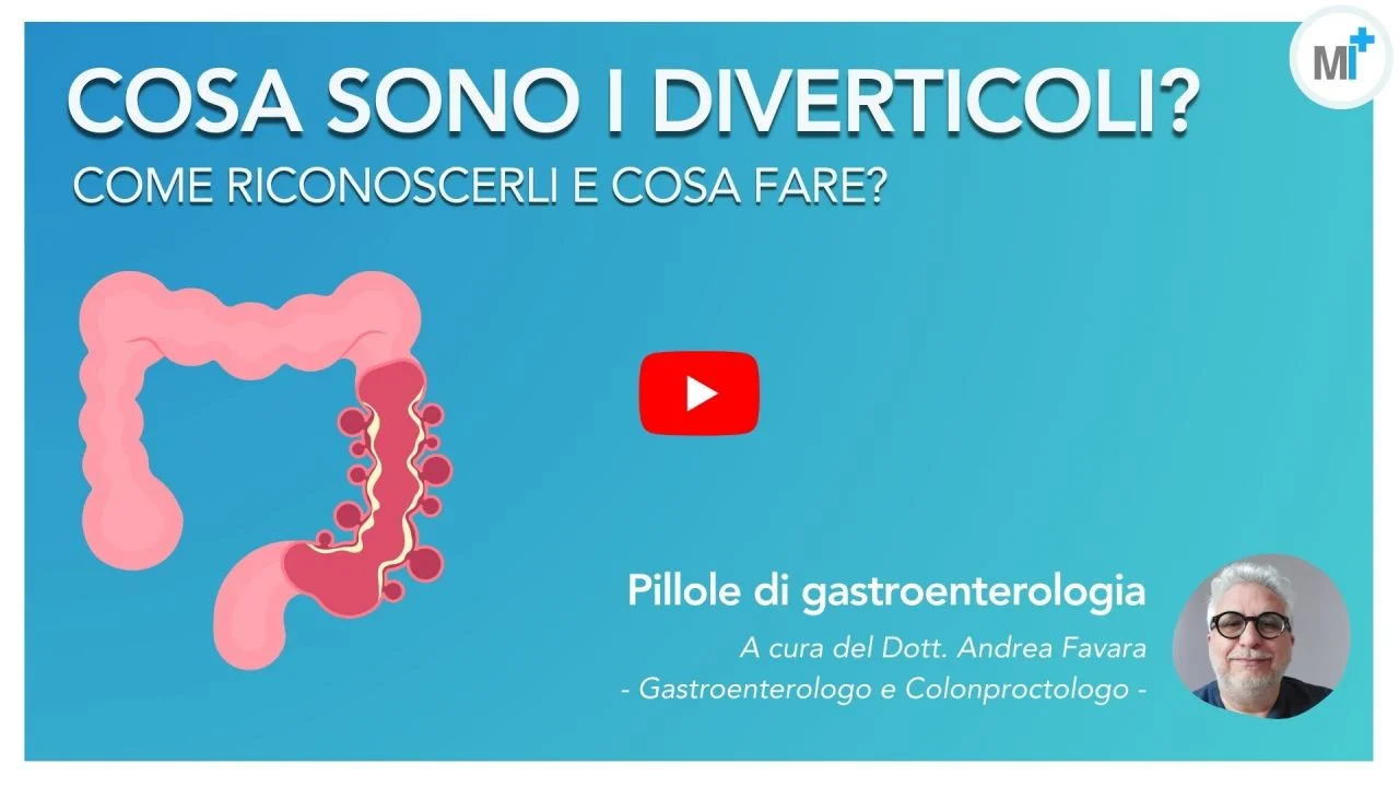 Diverticoli, diverticolite, diverticolosi: cosa sono?