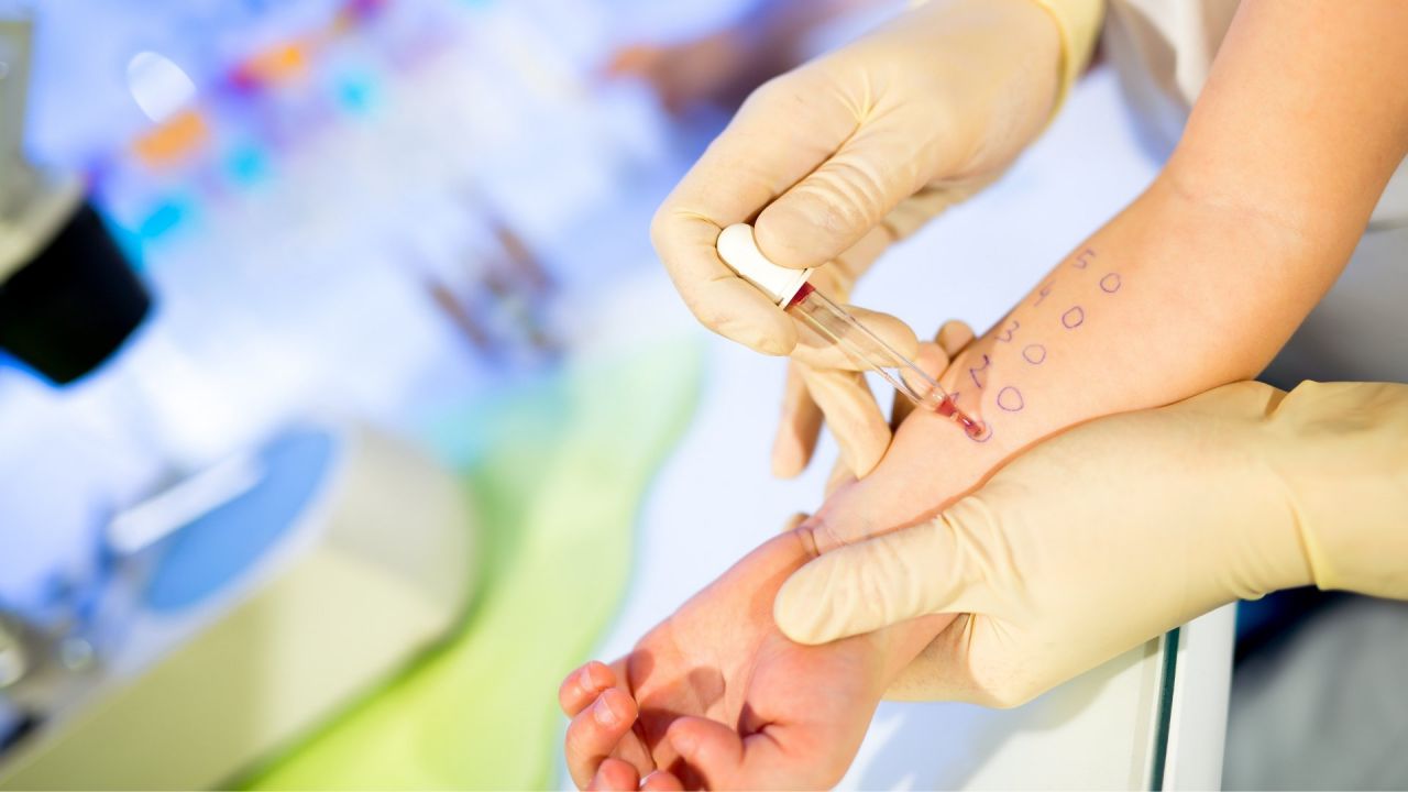 Prick-test: cos'è e come si esegue?