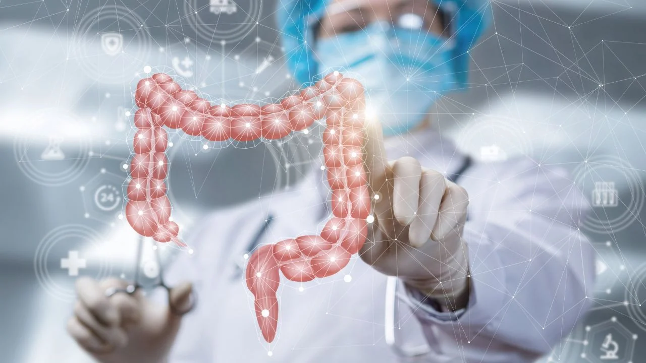 Tumore del colon retto: cause, sintomi, esami, prevenzione